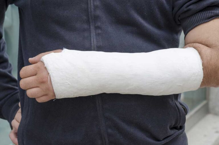 All types of plaster - Dr. Yash Shah